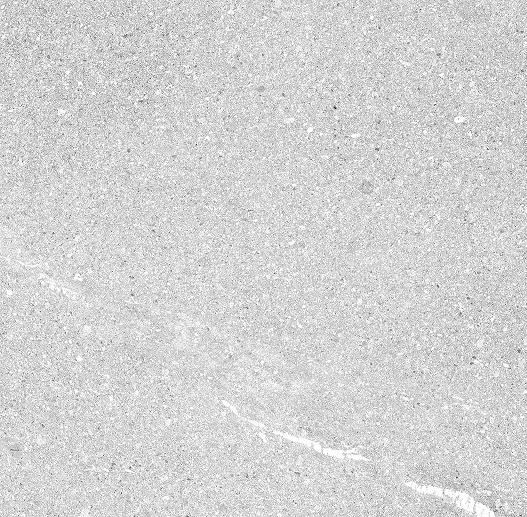 Commercial: CT Lington Perla R11